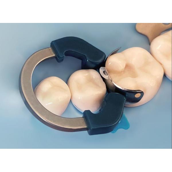Zt Dental Sectional Matrix System Dentistry Sectional Matrix Clamp Ring ...